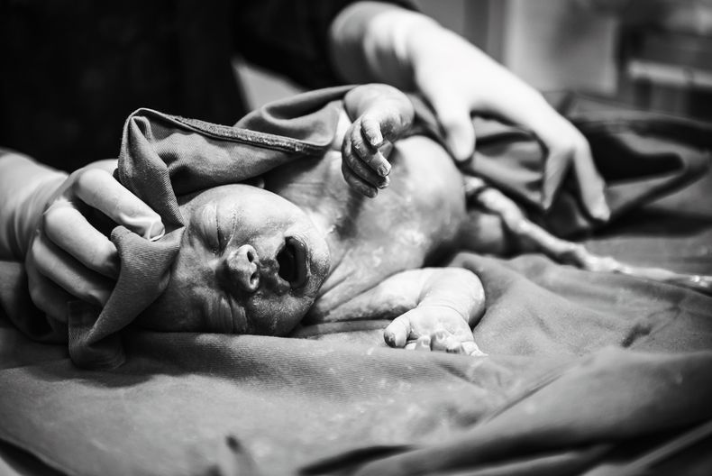 Puérpera, el trabajo de parto retratado en fotos